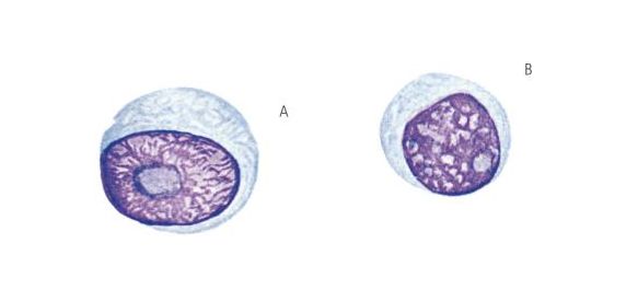 Linfocito: definizione e significato medico | Corriere Salute