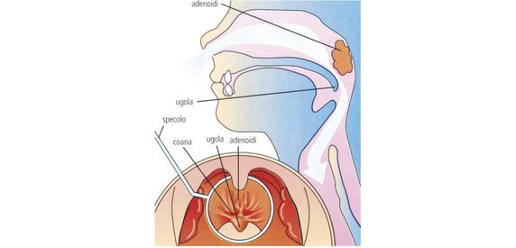 Adenoidi: definizione e significato medico | Corriere Salute