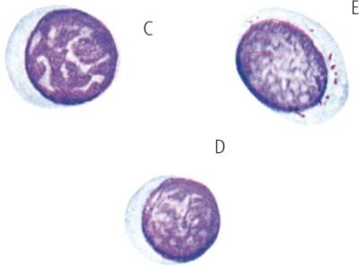 Linfocito: definizione e significato medico | Corriere Salute