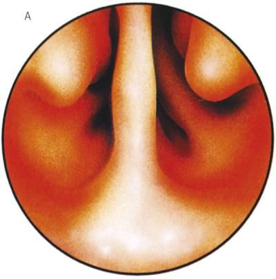 Setto: definizione e significato medico | Corriere Salute