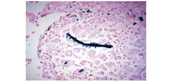 Sistema immunitario: definizione e significato medico | Corriere Salute