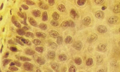 Laringe: definizione e significato medico | Corriere Salute