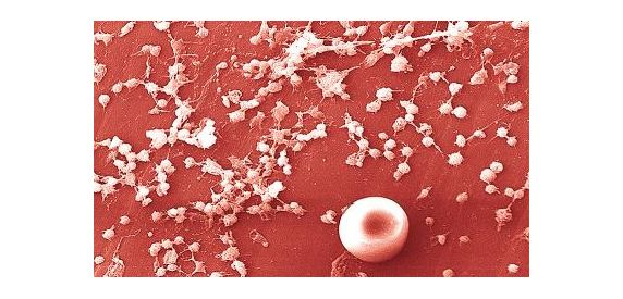 Nefrite: definizione e ultime news | Corriere Salute