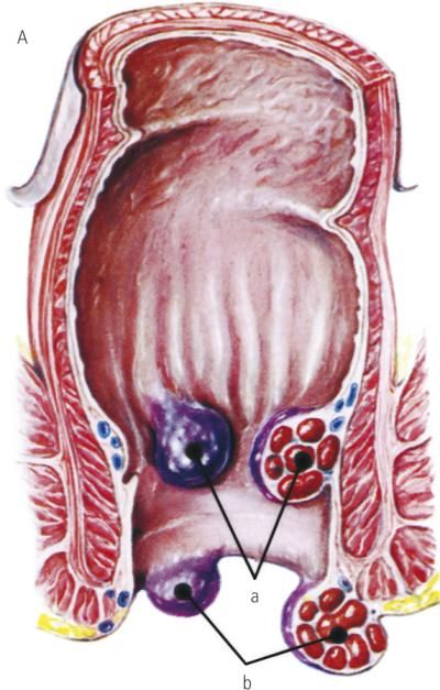 Proctologia: definizione e significato medico | Corriere Salute