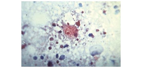 Rickettsia: definizione e significato medico | Corriere Salute