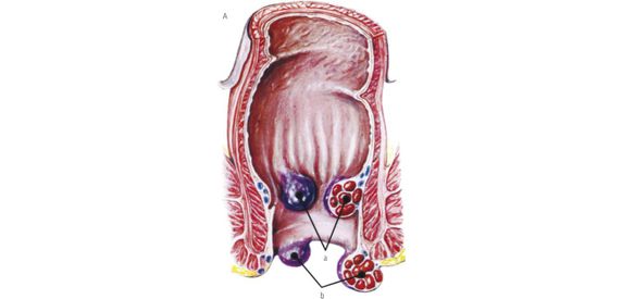 Proctologia: definizione e significato medico | Corriere Salute