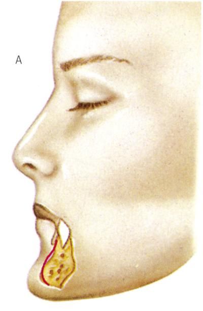 Mento: definizione e significato medico | Corriere Salute