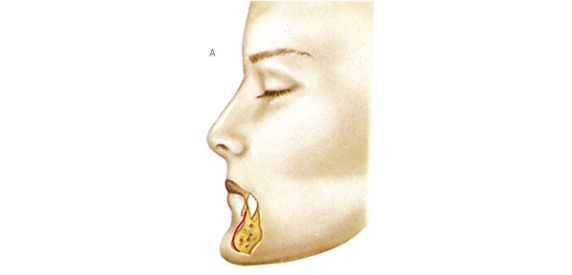 Mento: definizione e significato medico | Corriere Salute