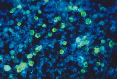 Mononucleosi infettiva: definizione e significato medico | Corriere Salute