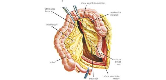 Emicolectomia: definizione e significato medico | Corriere Salute