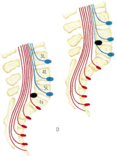 Nevralgia: definizione e significato medico | Corriere Salute