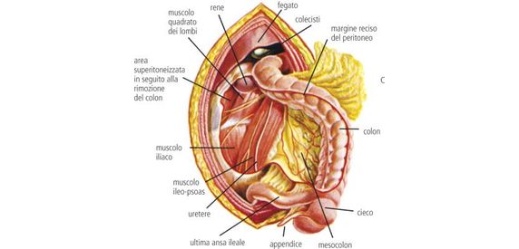 Emicolectomia: definizione e significato medico | Corriere Salute