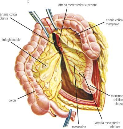 Emicolectomia: definizione e significato medico | Corriere Salute
