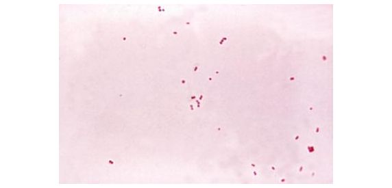 Meningococco: definizione e significato medico | Corriere Salute