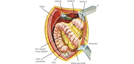 Emicolectomia: definizione e significato medico | Corriere Salute
