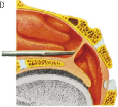 Atresia: definizione e significato medico | Corriere Salute