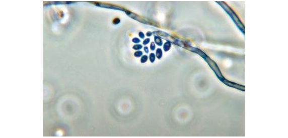 Micosi: definizione e significato medico | Corriere Salute