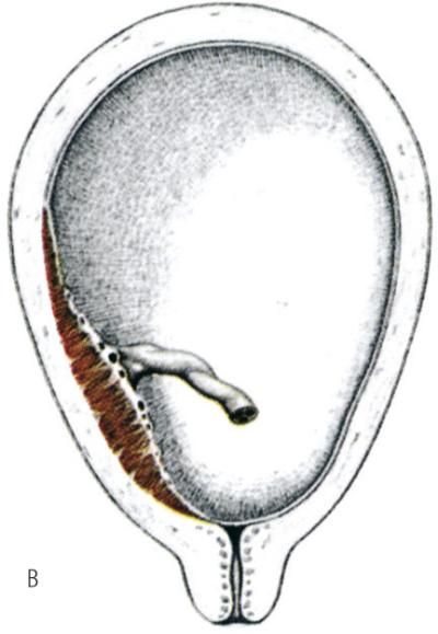 Placenta: definizione e significato medico | Corriere Salute