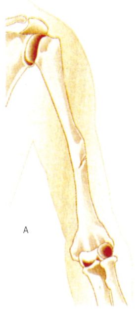 Omero: definizione e significato medico | Corriere Salute