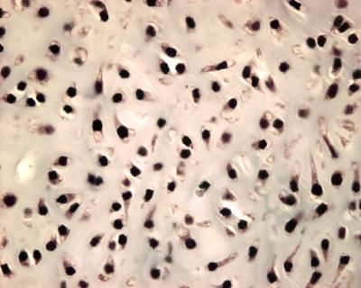 Condrociti: definizione e significato medico | Corriere Salute