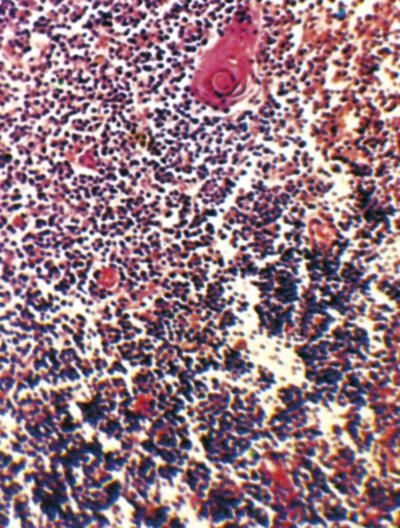 Corpuscoli di hassall: definizione e ultime news | Corriere Salute