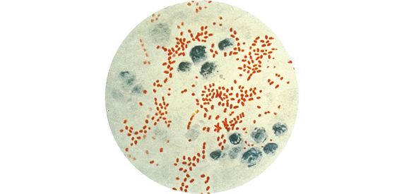 Pasteurella: definizione e significato medico | Corriere Salute