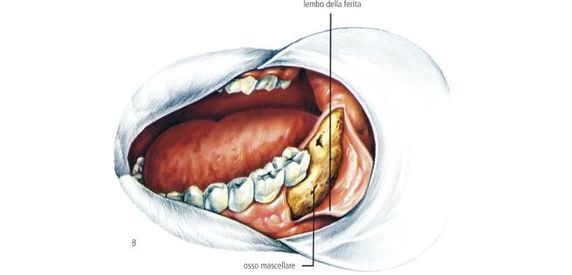 Dente: definizione e significato medico | Corriere Salute