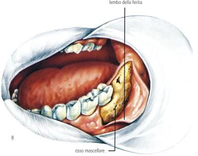 Dente: definizione e significato medico | Corriere Salute