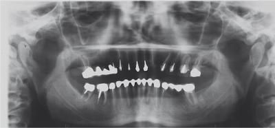Parodonto: definizione e significato medico | Corriere Salute