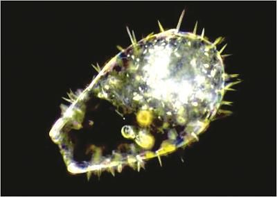 Ameba: definizione e significato medico | Corriere Salute