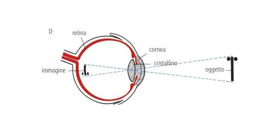 Ametropia: definizione e significato medico | Corriere Salute