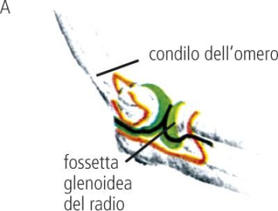 Gomito: definizione e significato medico | Corriere Salute