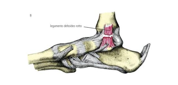 Frattura del piede: definizione e significato medico | Corriere Salute