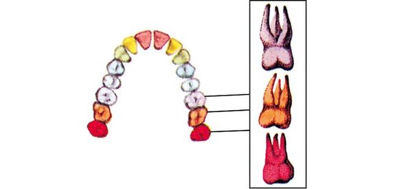Dente molare: definizione e significato medico | Corriere Salute