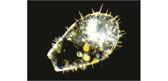 Ameba: definizione e significato medico | Corriere Salute