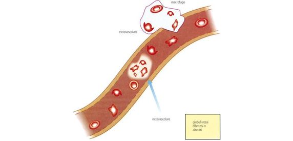 Emolisi: definizione e significato medico | Corriere Salute