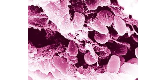 Peste: definizione e significato medico | Corriere Salute