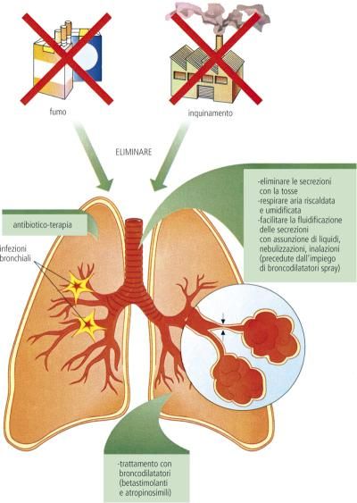 Bronchite: definizione e significato medico | Corriere Salute