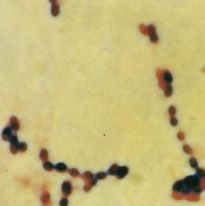 Enterocolite: definizione e significato medico | Corriere Salute