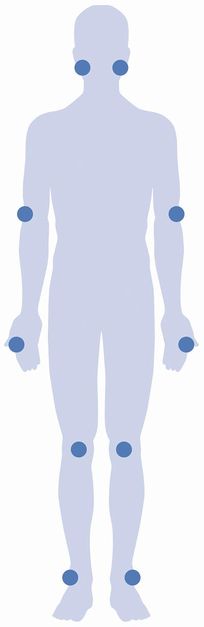 Dermatomiosite: definizione e significato medico | Corriere Salute