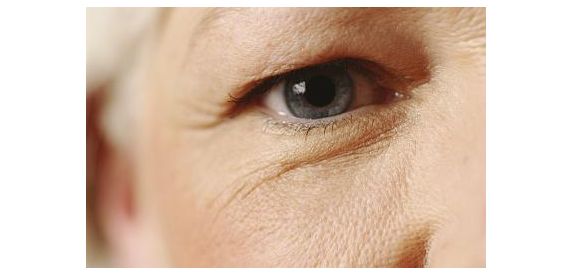 Botulino: definizione e significato medico | Corriere Salute