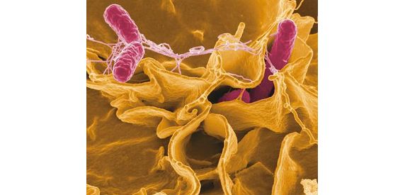 Paratifo: definizione e significato medico | Corriere Salute