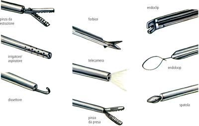 Appendicectomia: definizione e significato medico | Corriere Salute