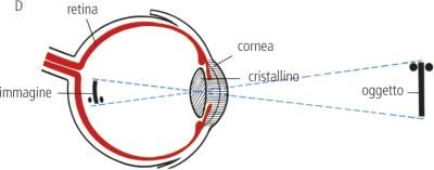 Ametropia: definizione e significato medico | Corriere Salute