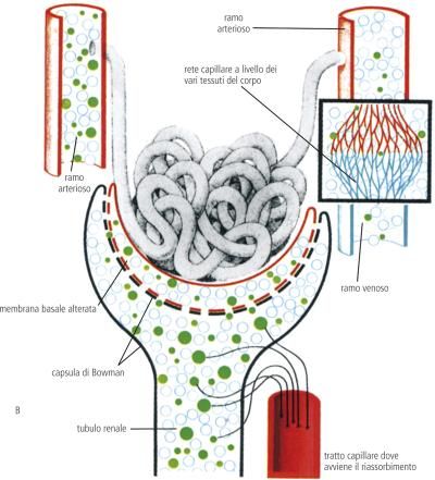Nefrosi: definizione e significato medico | Corriere Salute