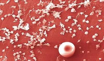 Nefrite: definizione e ultime news | Corriere Salute