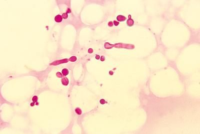 Pitiriasi: definizione e significato medico | Corriere Salute