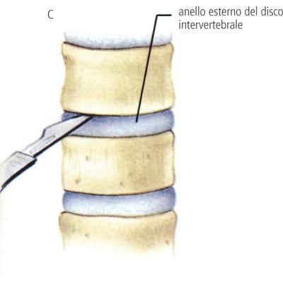 Midollo spinale: definizione e significato medico | Corriere Salute