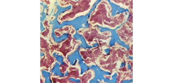 Diploe: definizione e significato medico | Corriere Salute