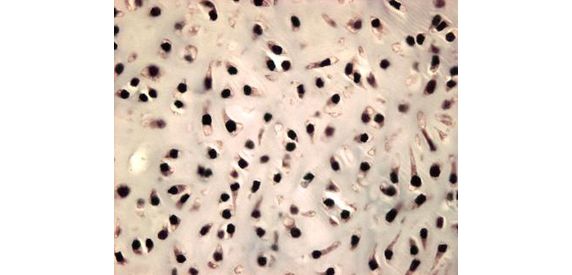 Condrociti: definizione e significato medico | Corriere Salute